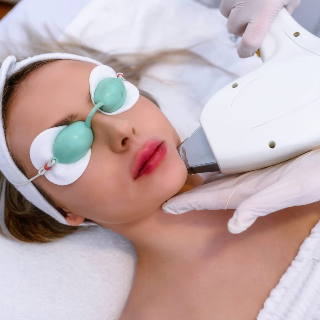Rejuvenare facială cu laser diode - Perfect Woman Salon